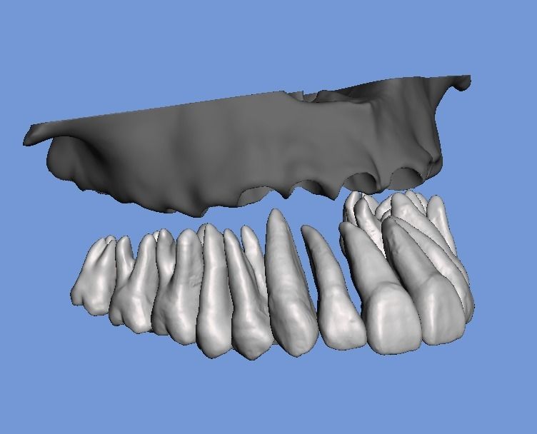 D006 Real human maxillary jaw anatomy with teeth 3D print model 3D ...