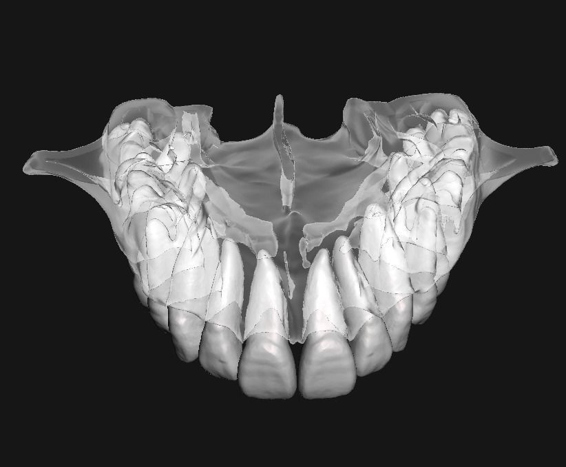 D006 Real human maxillary jaw anatomy with teeth 3D print model 3D ...