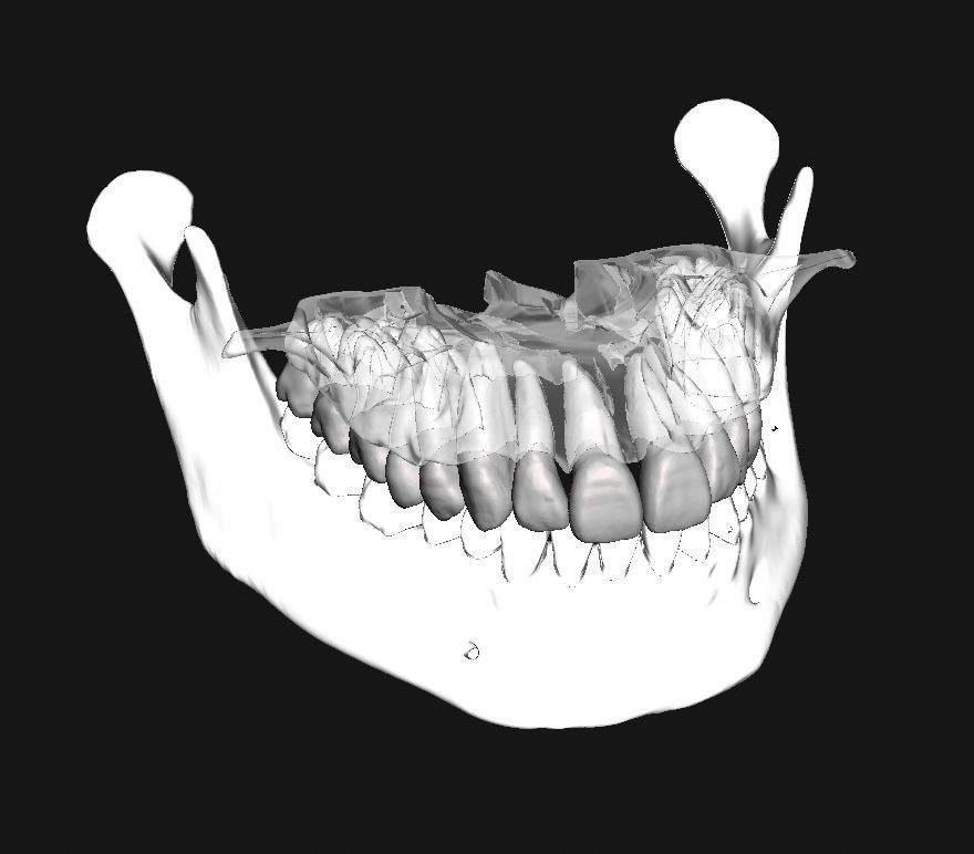 D006 Real human maxillary jaw anatomy with teeth 3D print model 3D ...