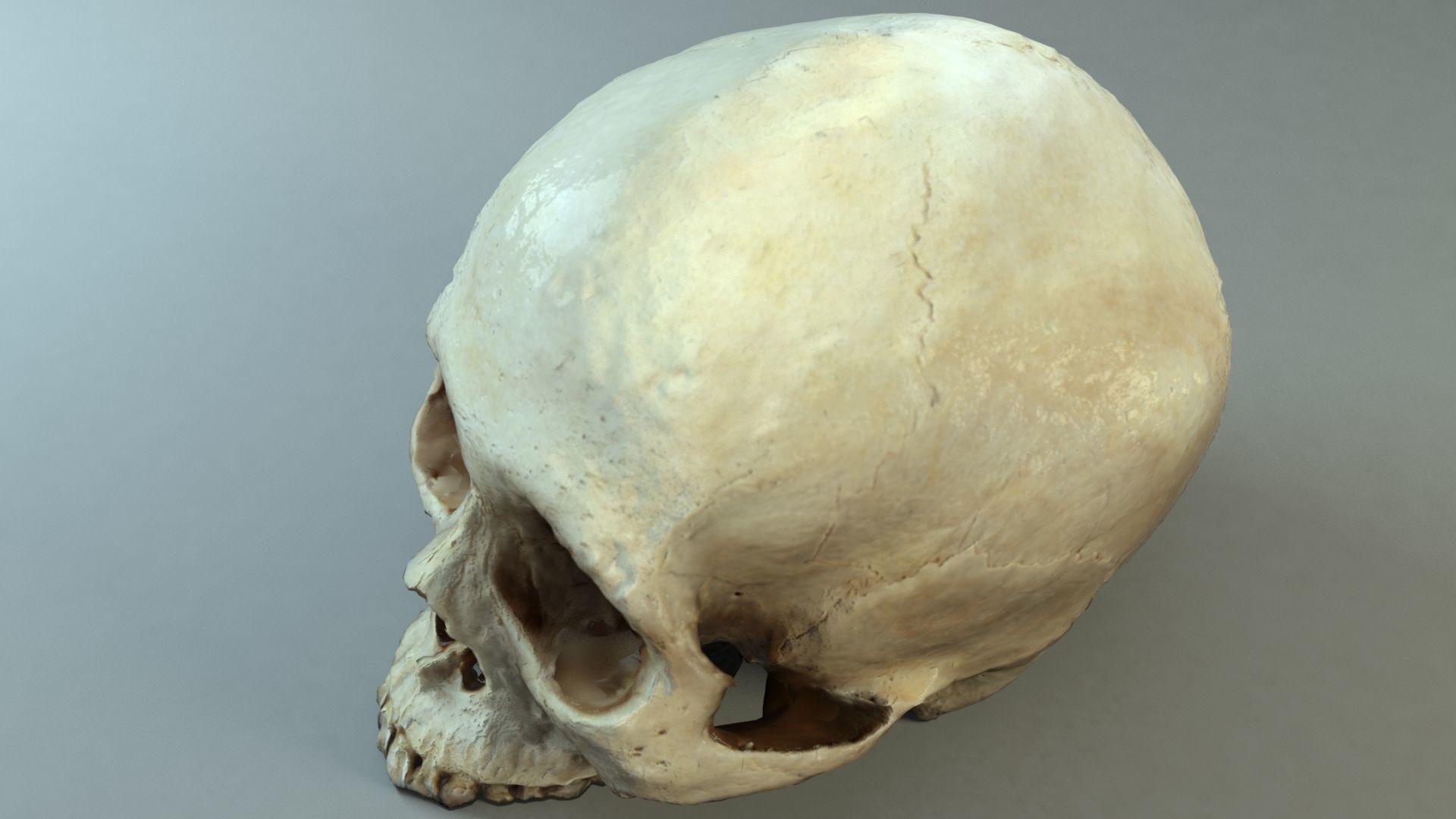 Human Skull Forensics specimen 3D model | CGTrader