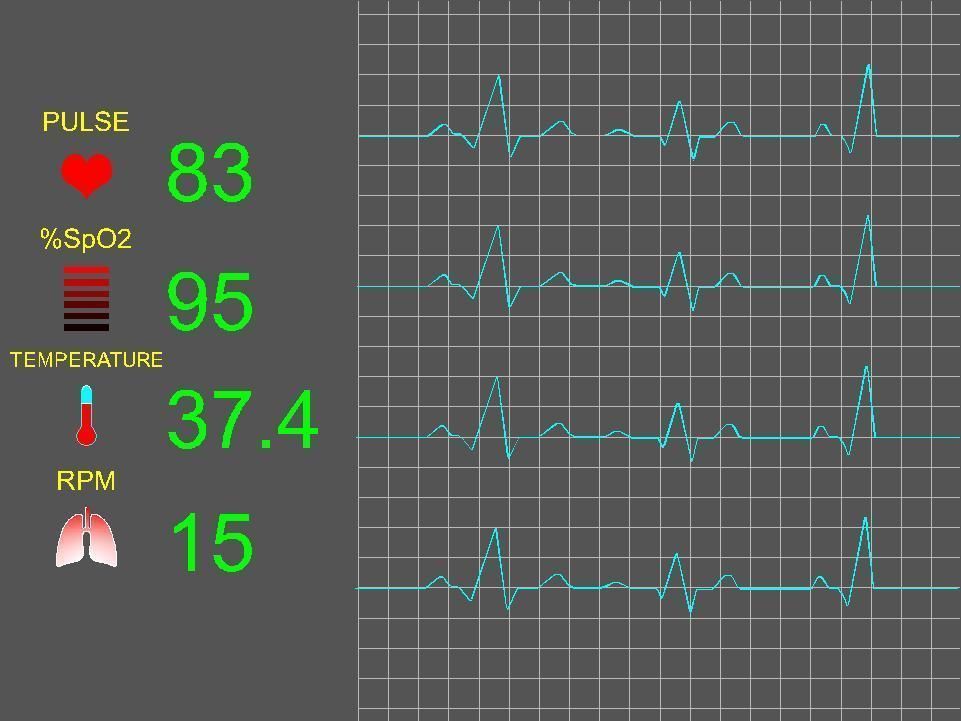 Vital functions monitor 3D model | CGTrader