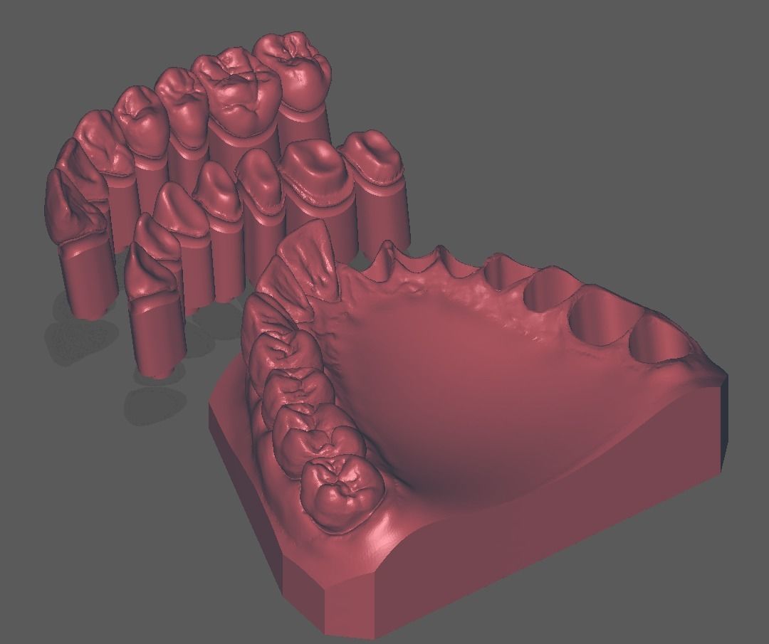 Dental training model Dental Sample model 3D model 3D printable | CGTrader