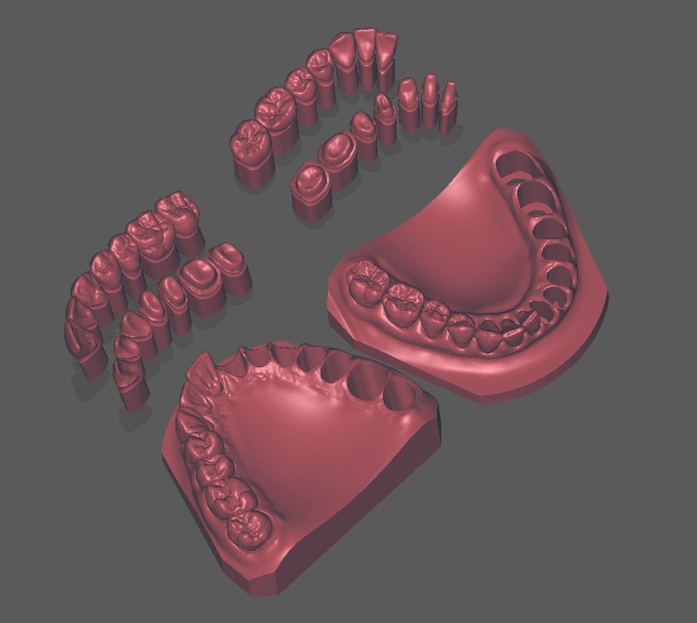 Dental training model Dental Sample model 3D model 3D printable | CGTrader