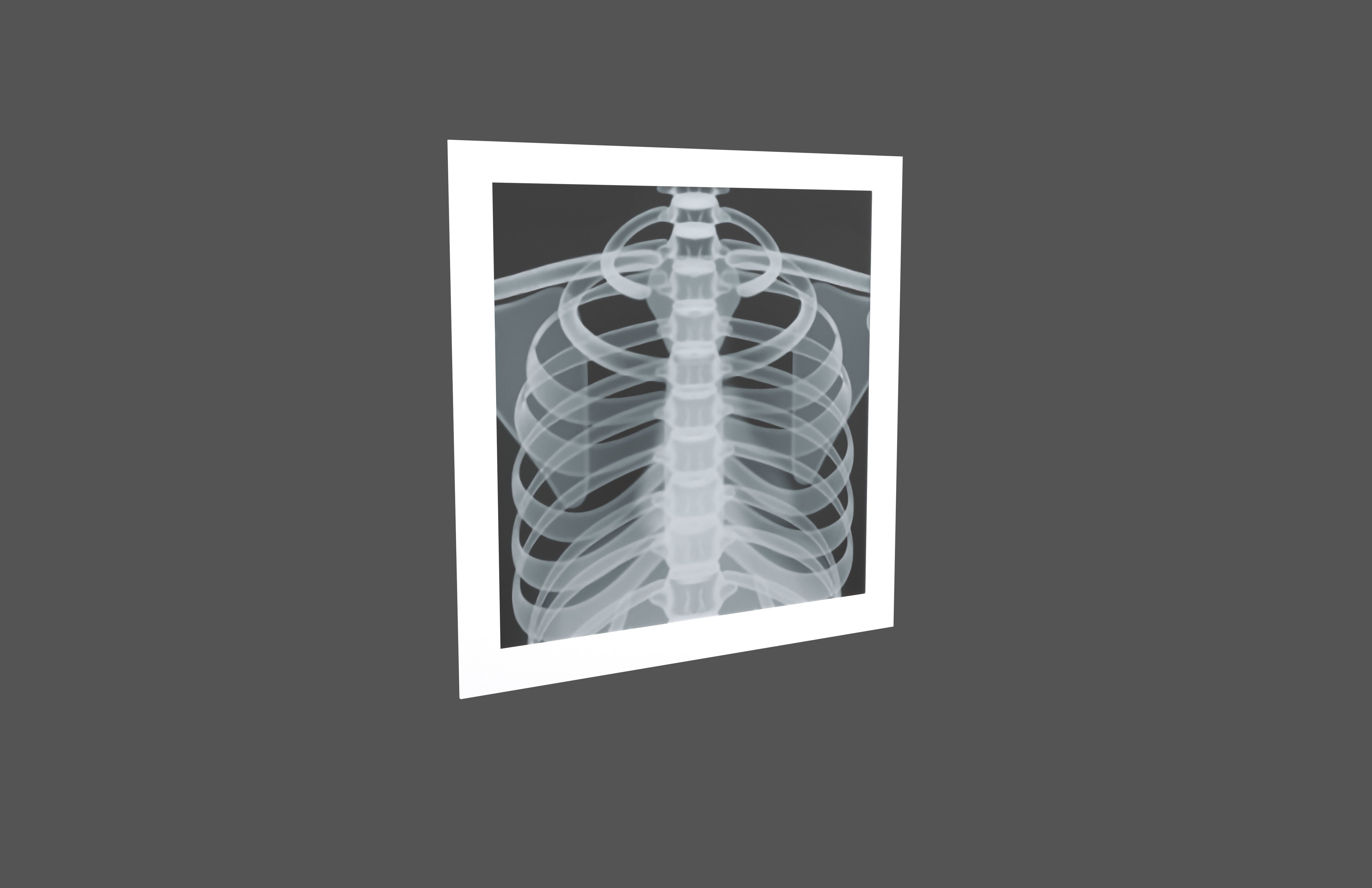 3D model X-Ray Emoji v1 002 VR / AR / low-poly | CGTrader