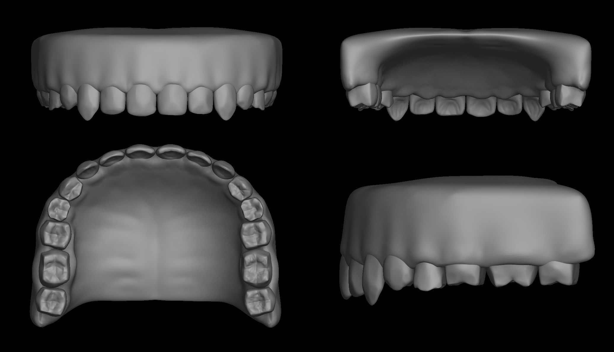 Teeth - Upper Jaw free 3D model 3D printable | CGTrader