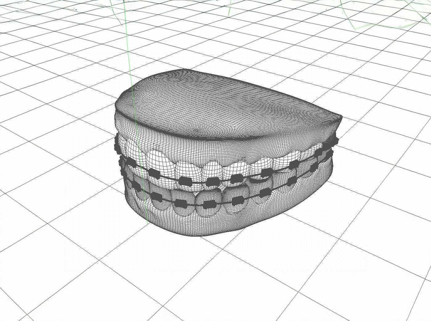 Fake Teeth And Braces 3D model | CGTrader