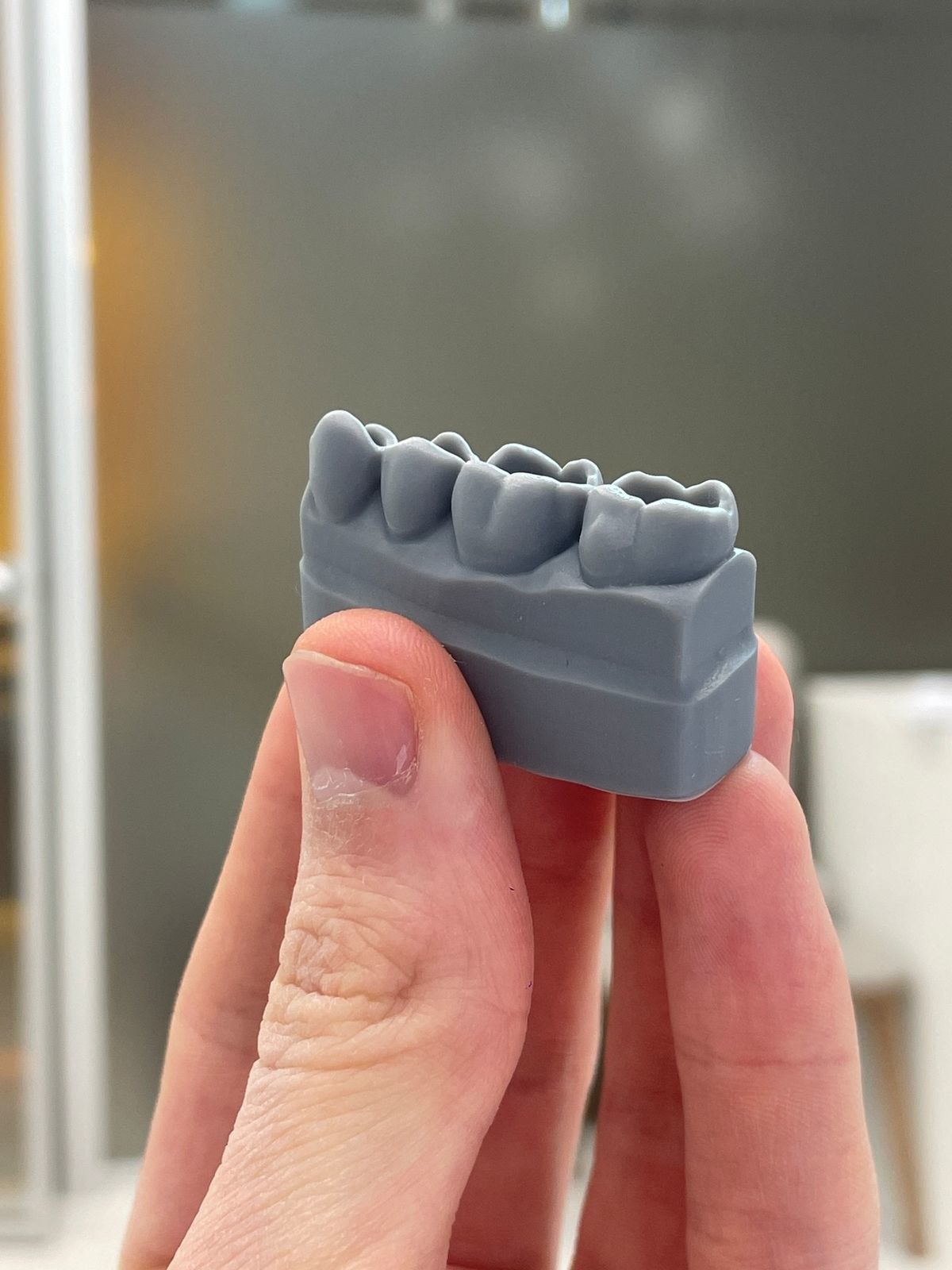 teeth model for restoration class 1 3D model 3D printable | CGTrader