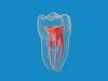 Natural Tooth with Pulp Cavity 3D model | CGTrader