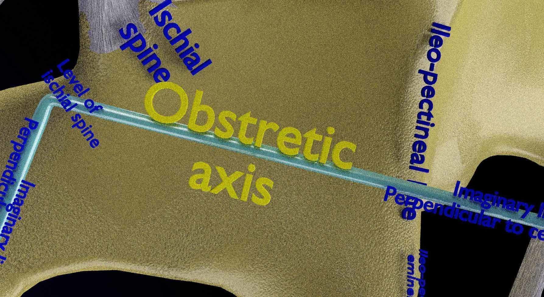 3D model Female pelvis clinical Pelvimetry dimension VR / AR / low-poly ...