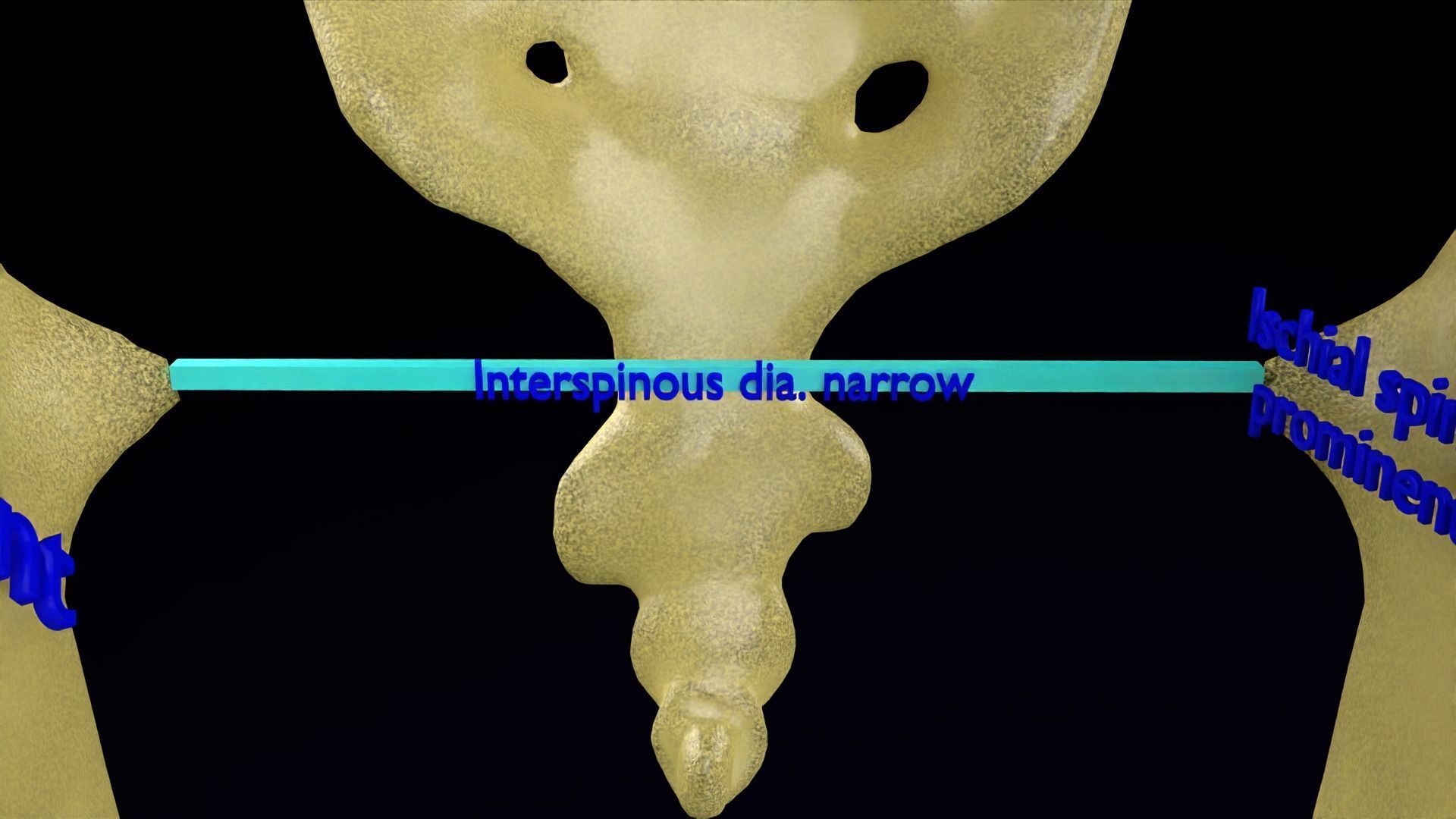 Pelvis types hip bone labelled detailed 3D model animated | CGTrader