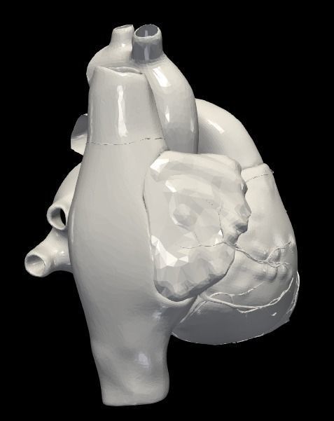 3d model of heart - apical 2 chamber plane 3D model 3D printable | CGTrader