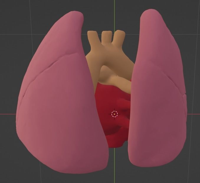 3D model of heart with transposition of the great arteries 3D model ...