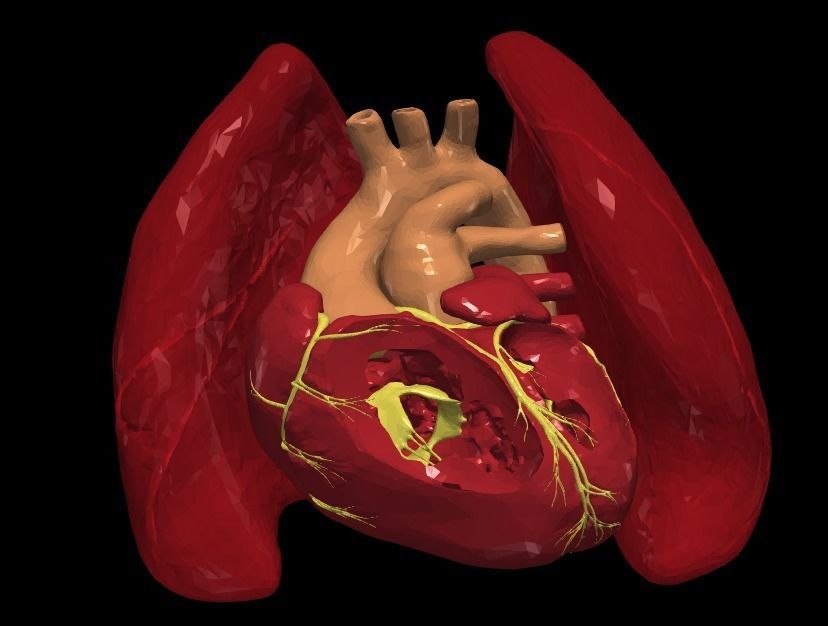 3D model of heart with transposition of the great arteries 3D model ...