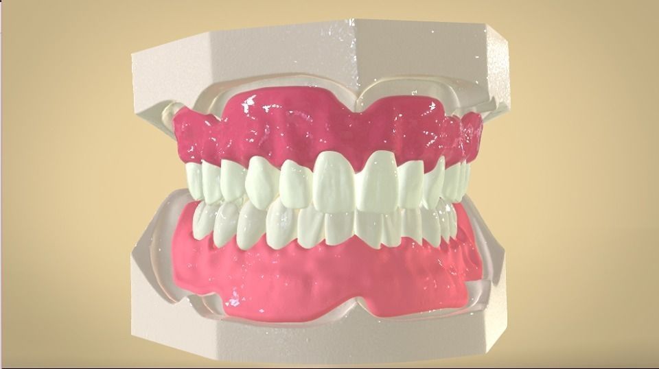 Digital Full Dentures 3D Model 3D printable STL - CGTrader.com