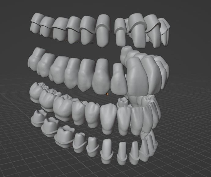 teeth restoration 3D print model 3D model 3D printable | CGTrader