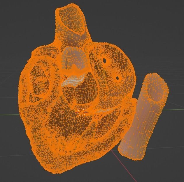 3d model of heart with atrioventricular septal defect 4 chamber 3D ...
