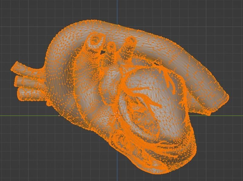 3d model of heart with atrial septal defect 3D model 3D printable ...