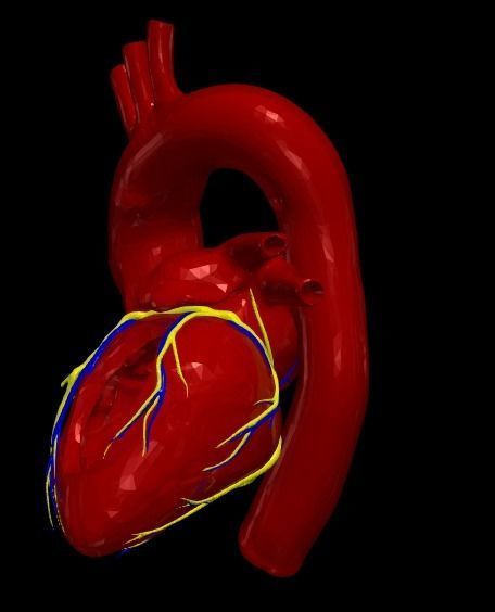 3d model of heart with atrial septal defect 3D model 3D printable ...