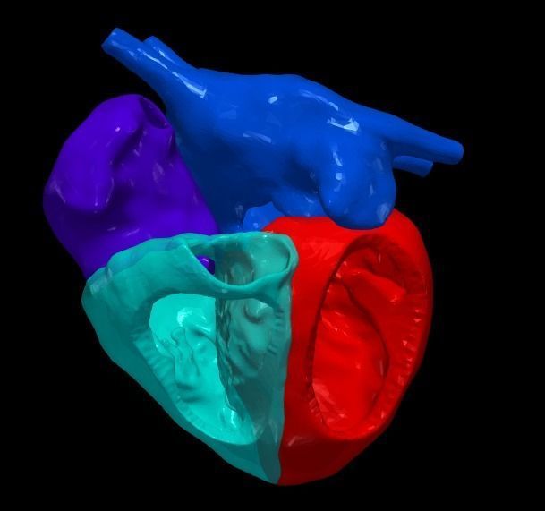 3d model of heart with bicuspid aortic valve 3D model 3D printable ...