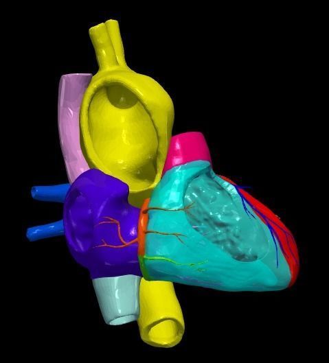 3d model of heart with bicuspid aortic valve 3D model 3D printable ...