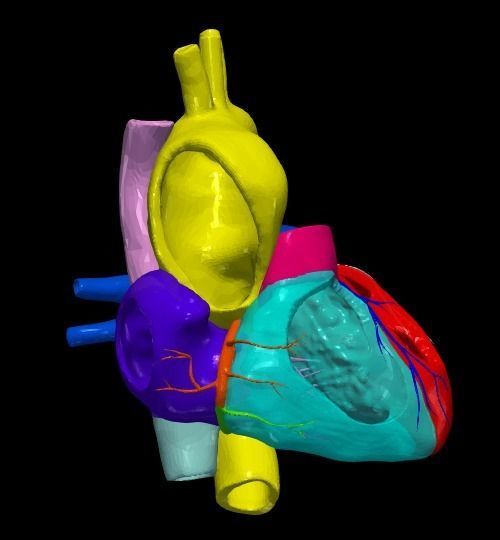 3d model of heart with bicuspid aortic valve 3D model 3D printable ...