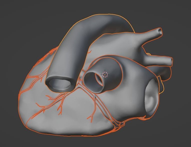 3d model of heart with bicuspid aortic valve 3D model 3D printable ...