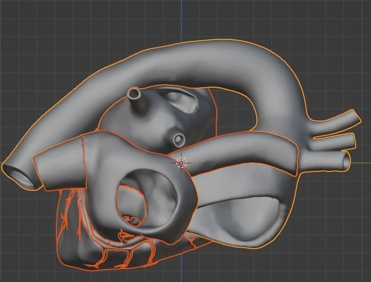3d model of heart with bicuspid aortic valve 3D model 3D printable ...