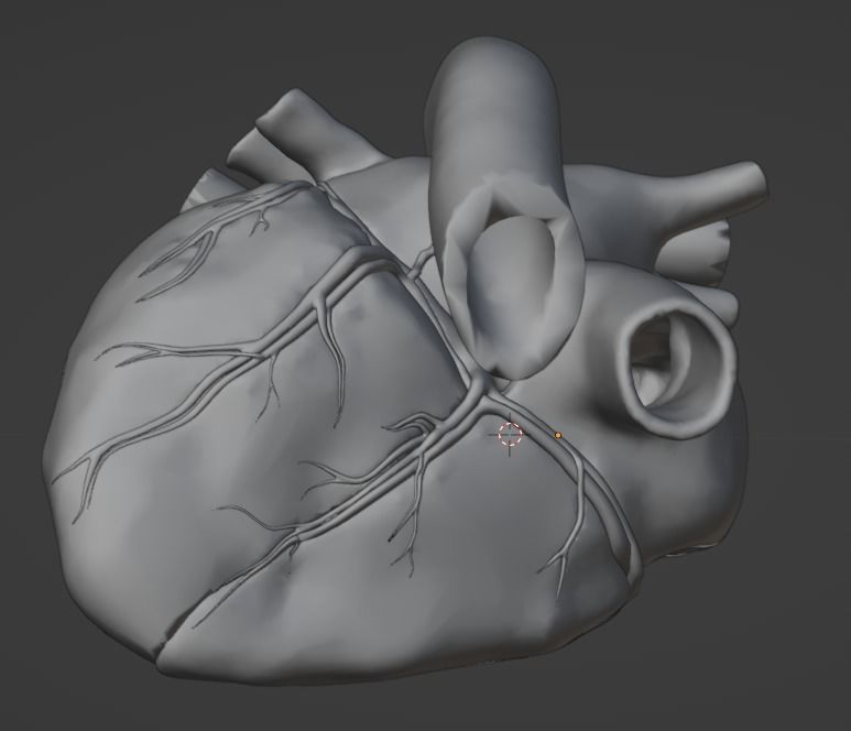3d model of heart with common arterial trunk 3D model 3D printable ...