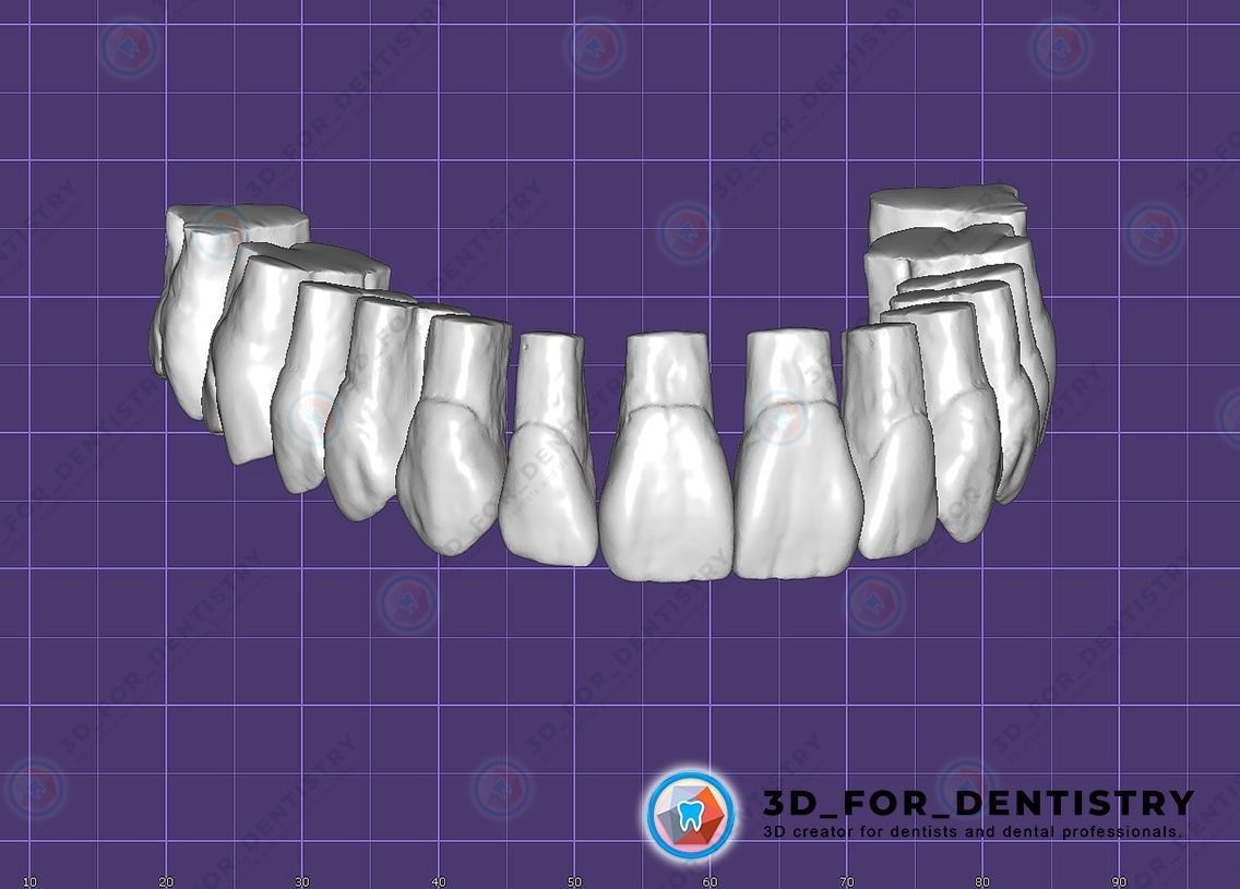 Dentes Maxila e Mandibula - Robtoly-Unique - Exocad 3D model | CGTrader