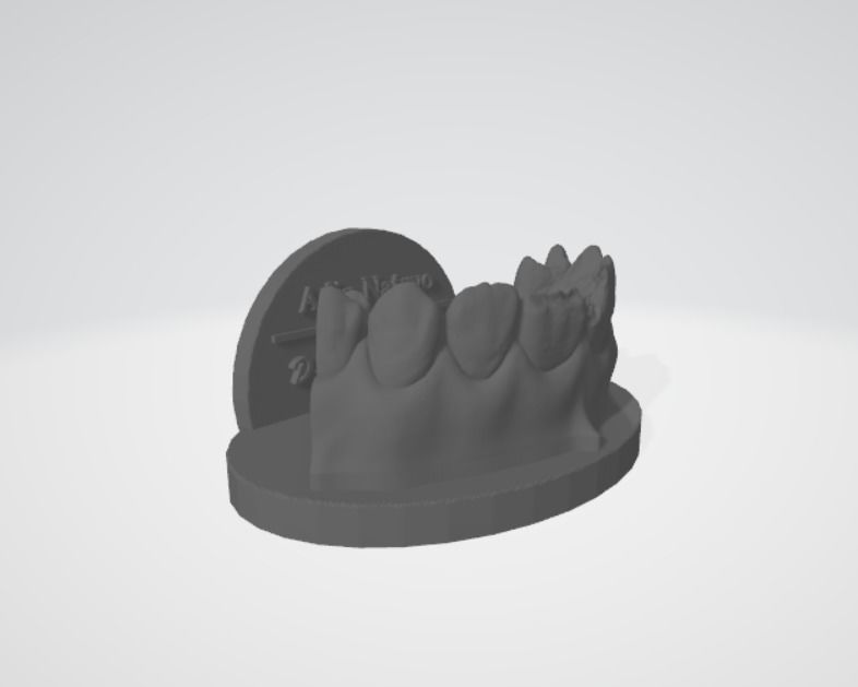 Segmented Anterior Class IV and Class VI by EDM DENTAL PRACTICE 3D ...