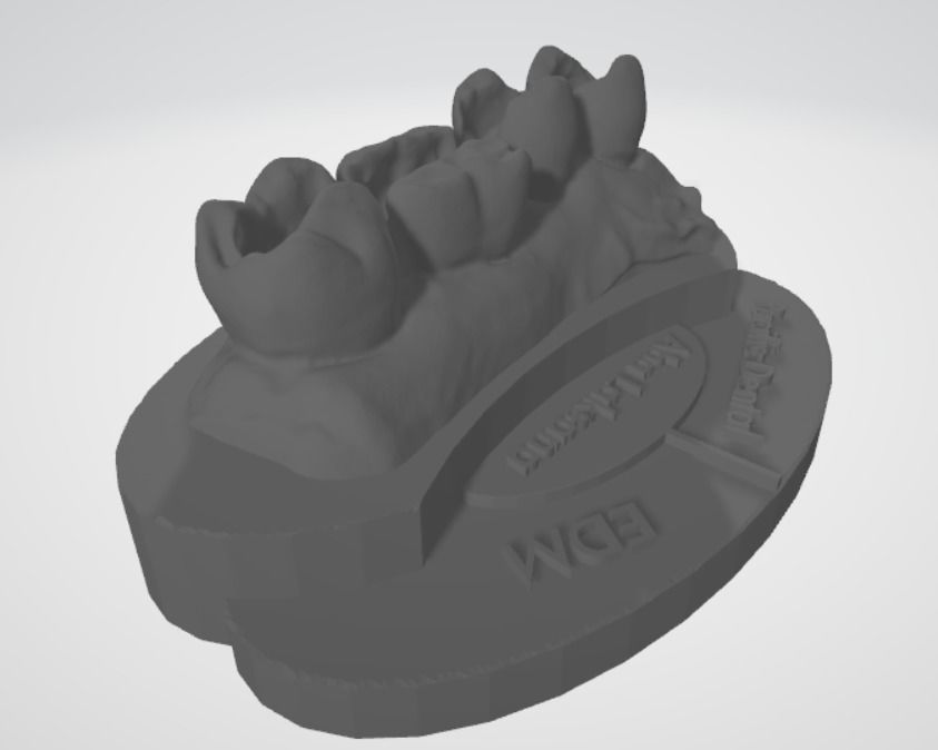 Posterior class 1 MOD Cups Reduction Class II by EDM DENTAL 3D model 3D ...