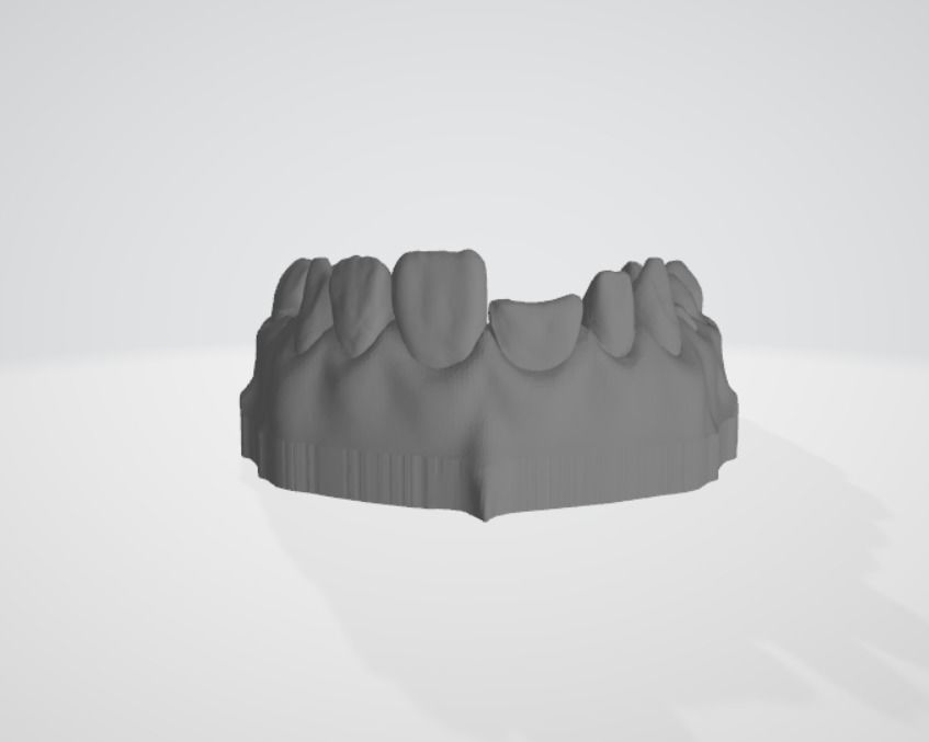 Segmented Full Mixed Arch Complex Cases by EDM DENTAL PRACTICE 3D model ...