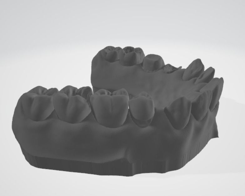 Segmented Full Mixed Arch Complex Cases by EDM DENTAL PRACTICE 3D model ...