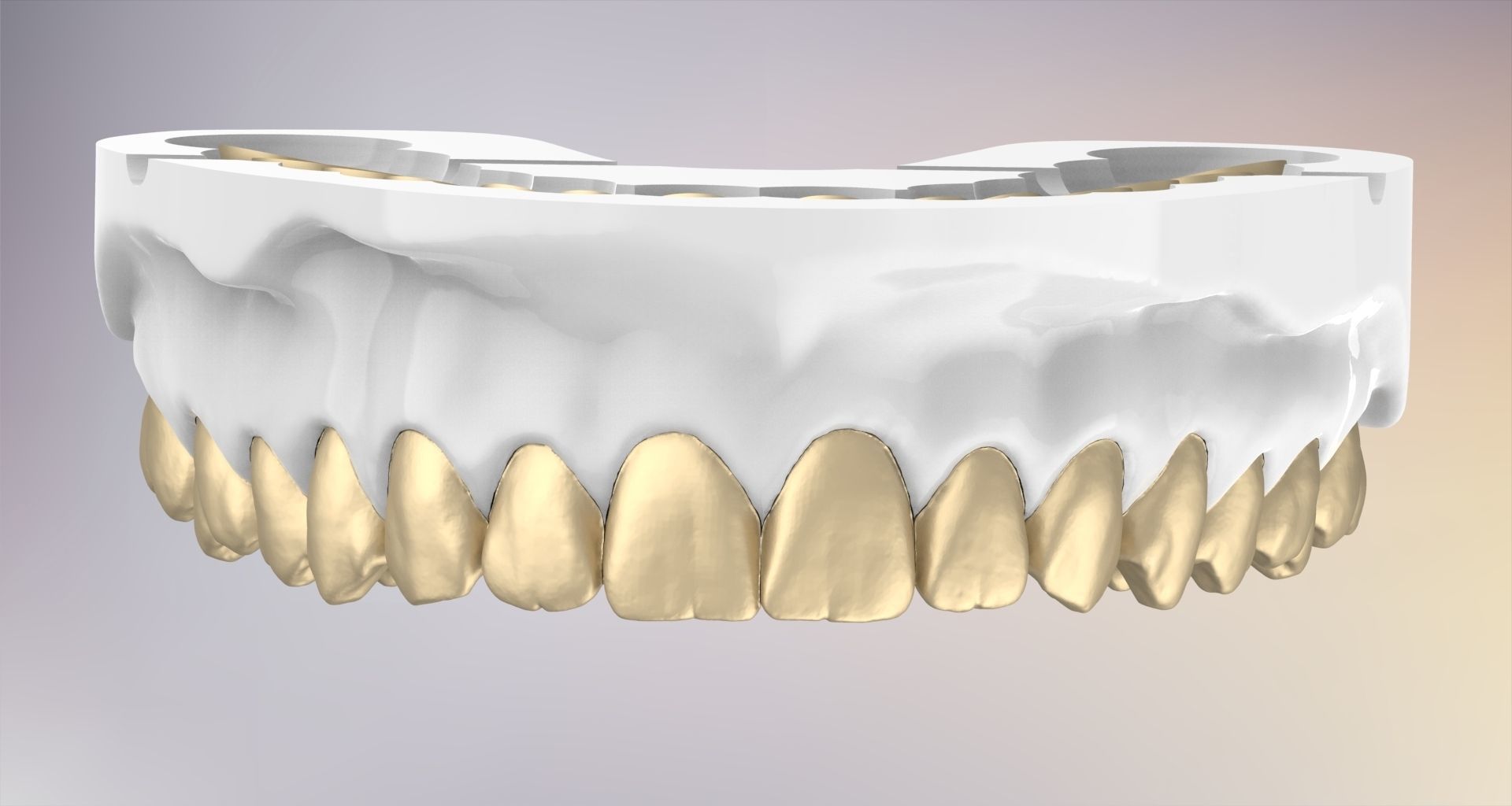 3D Dental Jaws Replica with Detachable Teeth 3D model 3D printable ...