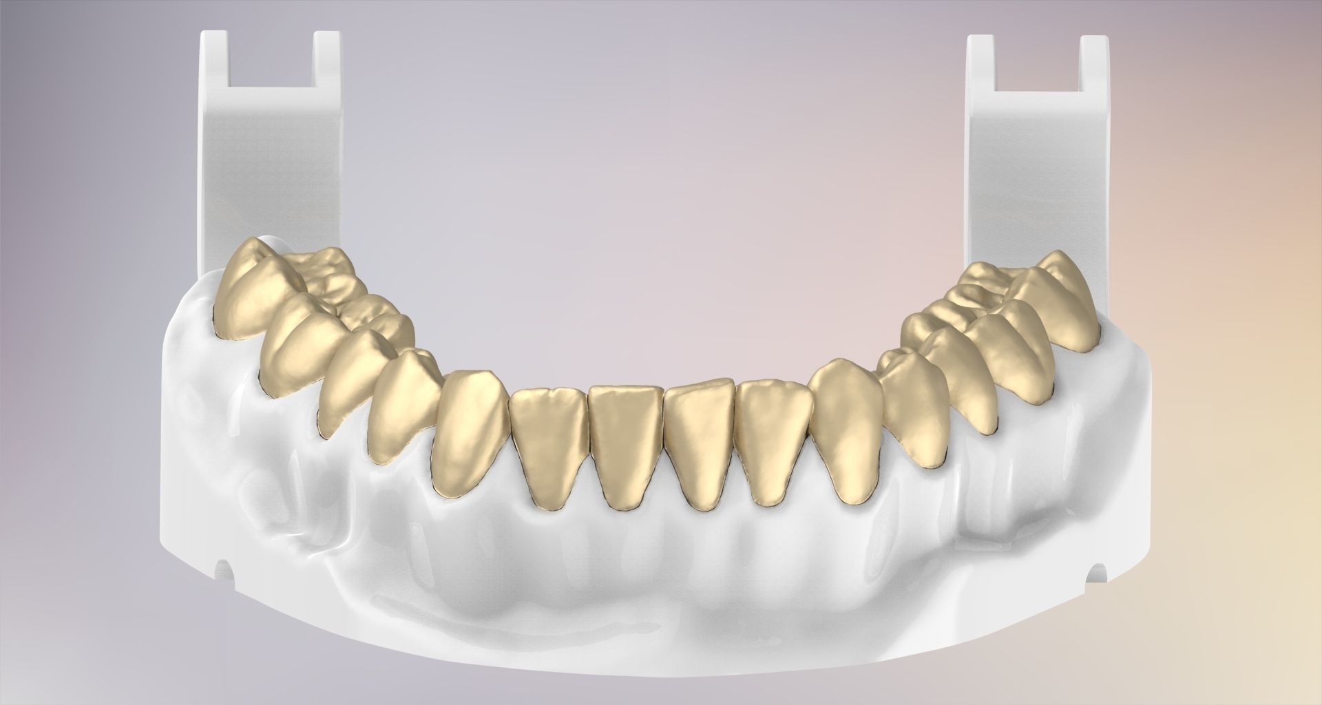 3D Dental Jaws Replica with Detachable Teeth 3D model 3D printable ...
