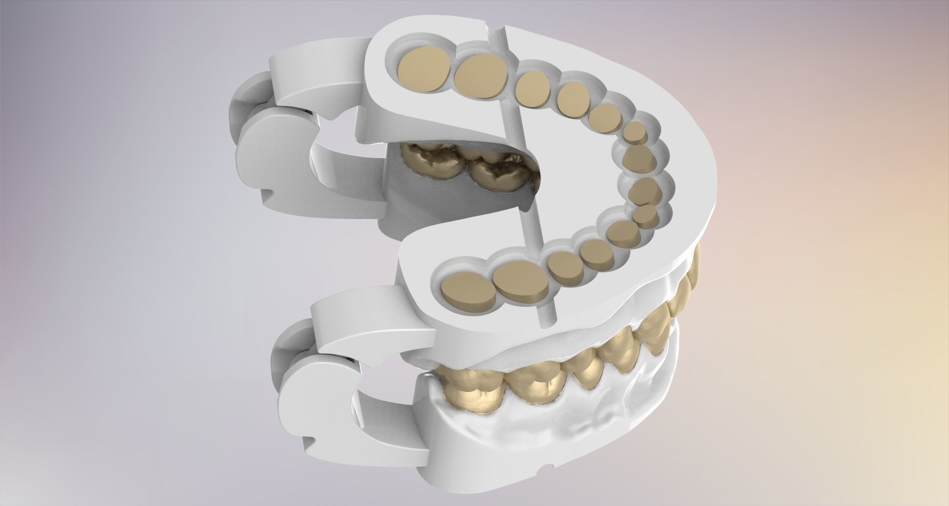 3D Dental Jaws Replica with Detachable Teeth 3D model 3D printable ...