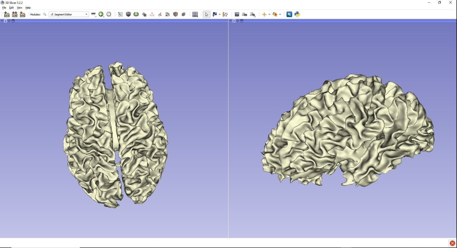 White matter of the brain 3D model 3D printable | CGTrader