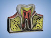 Medical Teeth Dental profile cortical structure 3D model | CGTrader