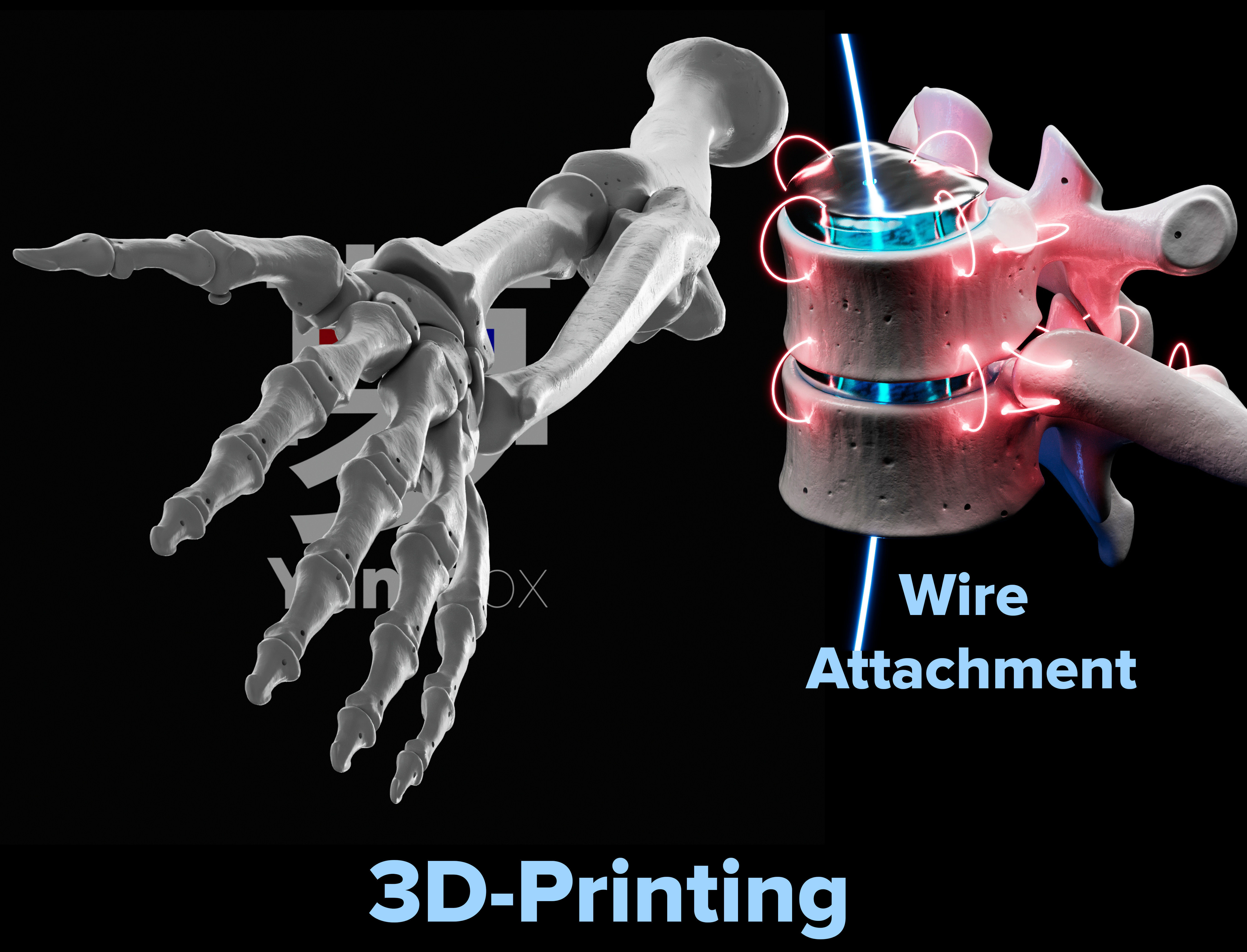 Human Lt Arm and Hand Bones 3D model 3D printable | CGTrader