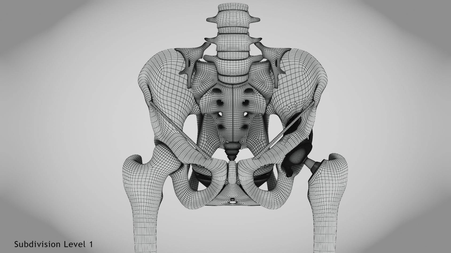 3D model Replaced Pelvic Implant VR / AR / low-poly | CGTrader