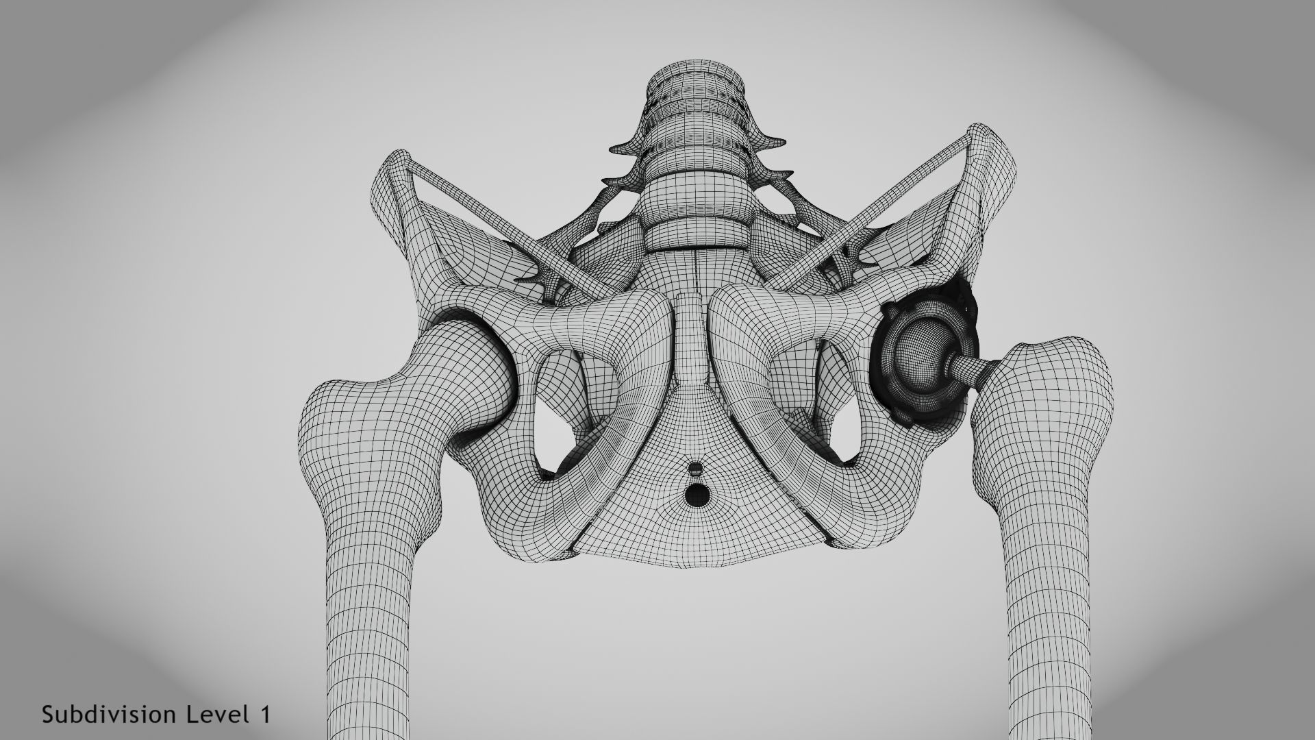3D model Replaced Pelvic Implant VR / AR / low-poly | CGTrader