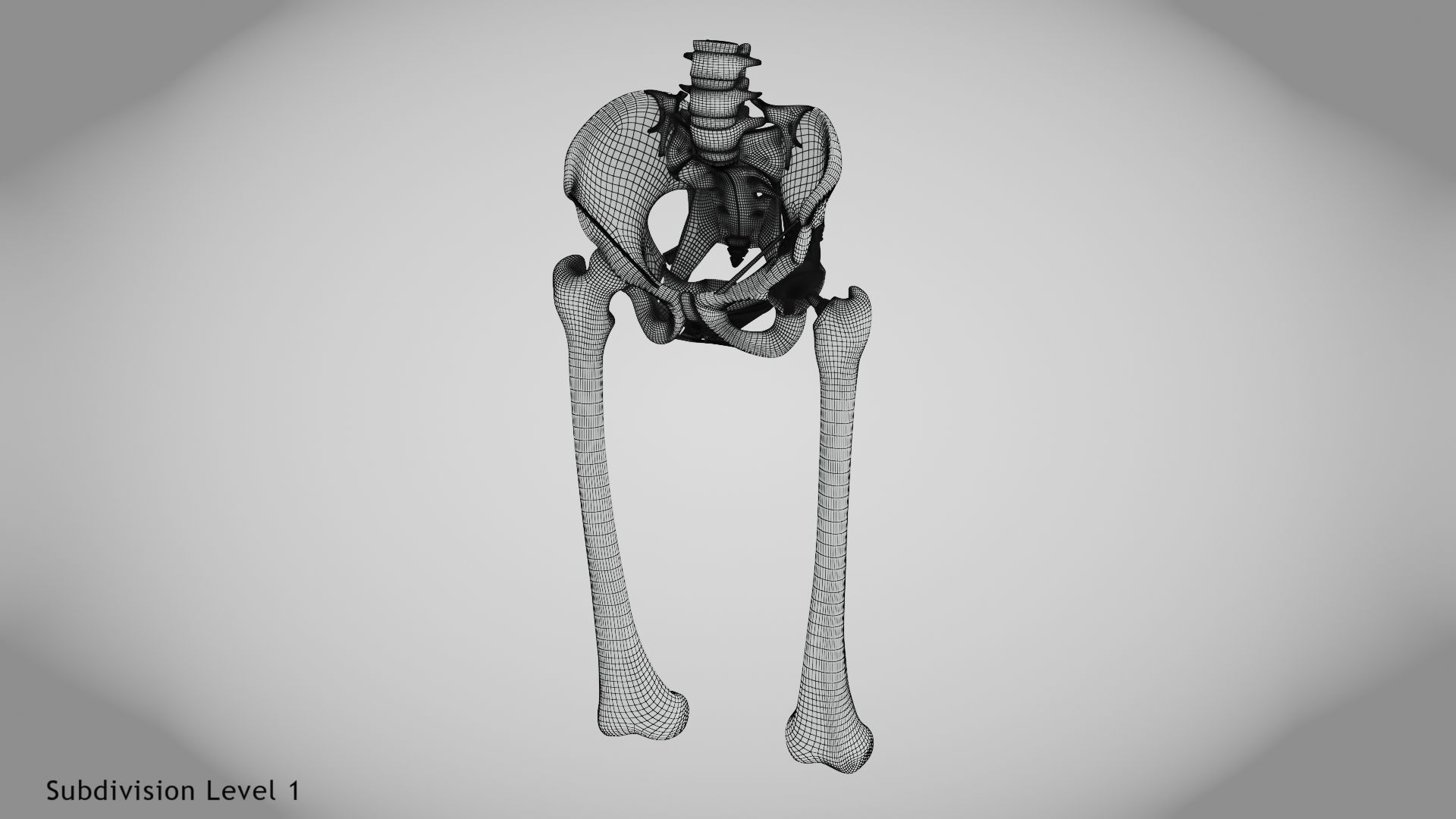 3D model Replaced Pelvic Implant VR / AR / low-poly | CGTrader
