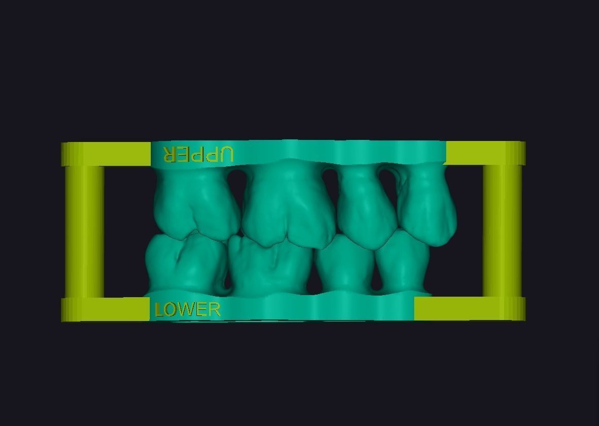 Dental training model Dental Sample model 3D print model 3D model 3D ...