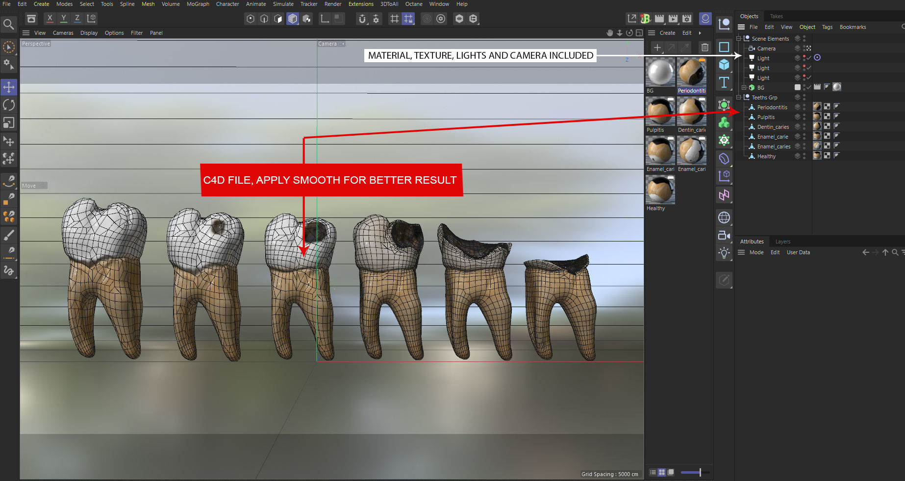 3D model Human Tooth Decay A 3D Dental Caries Progression Model VR / AR ...