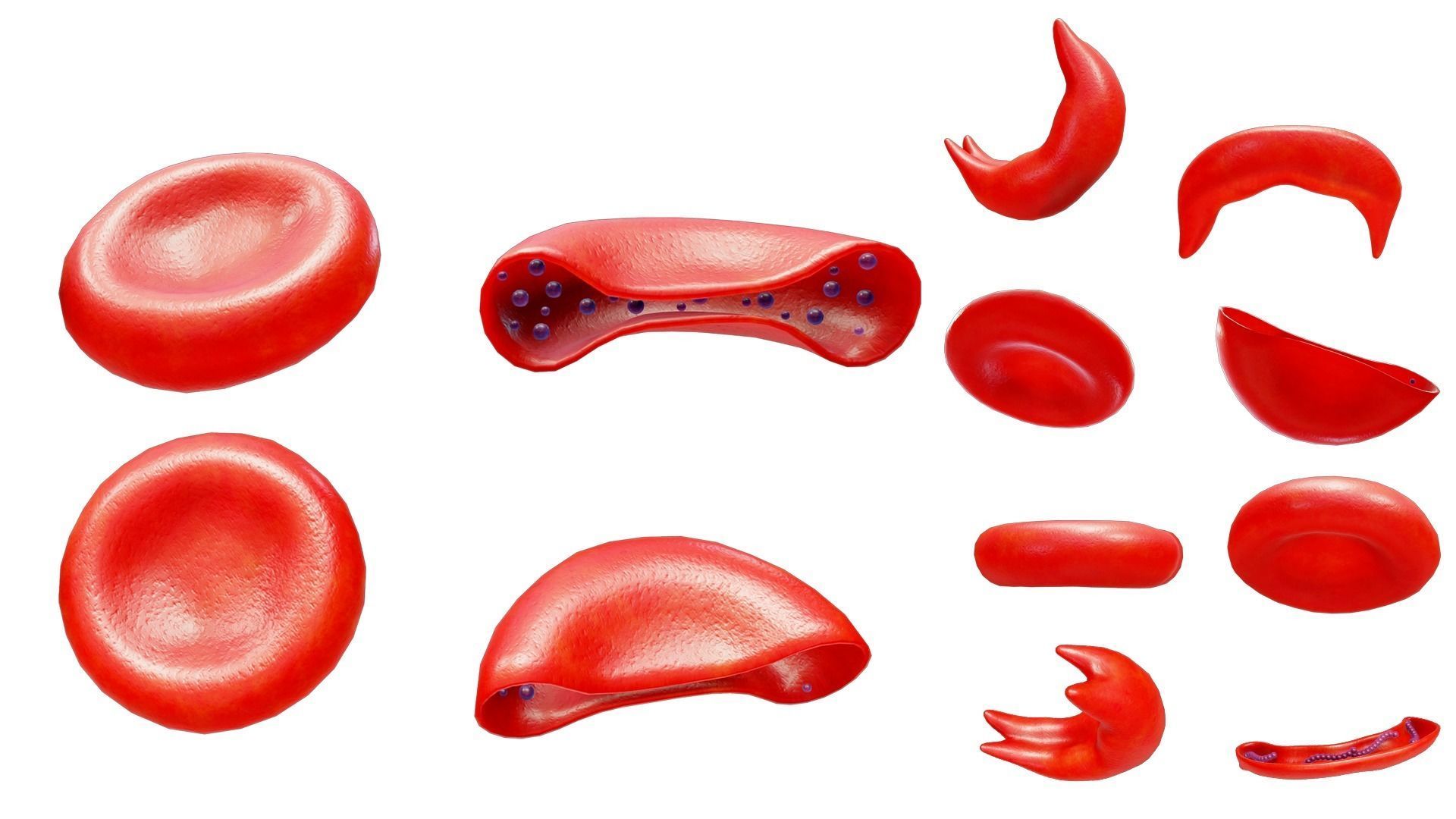 Cross Section of Normal vs Sickle Red Blood Cell 3D model | CGTrader