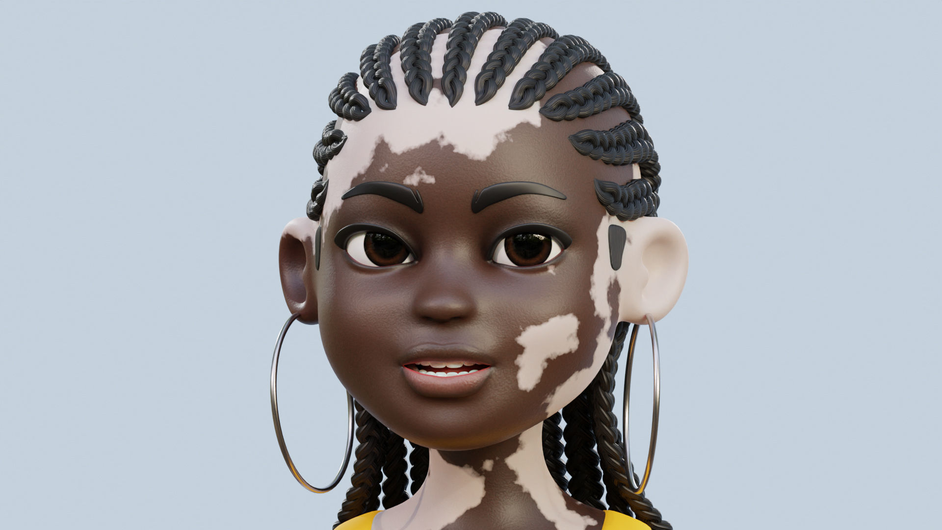 3D model Cartoon Girl with Vitiligo Sophia VR / AR / low-poly | CGTrader