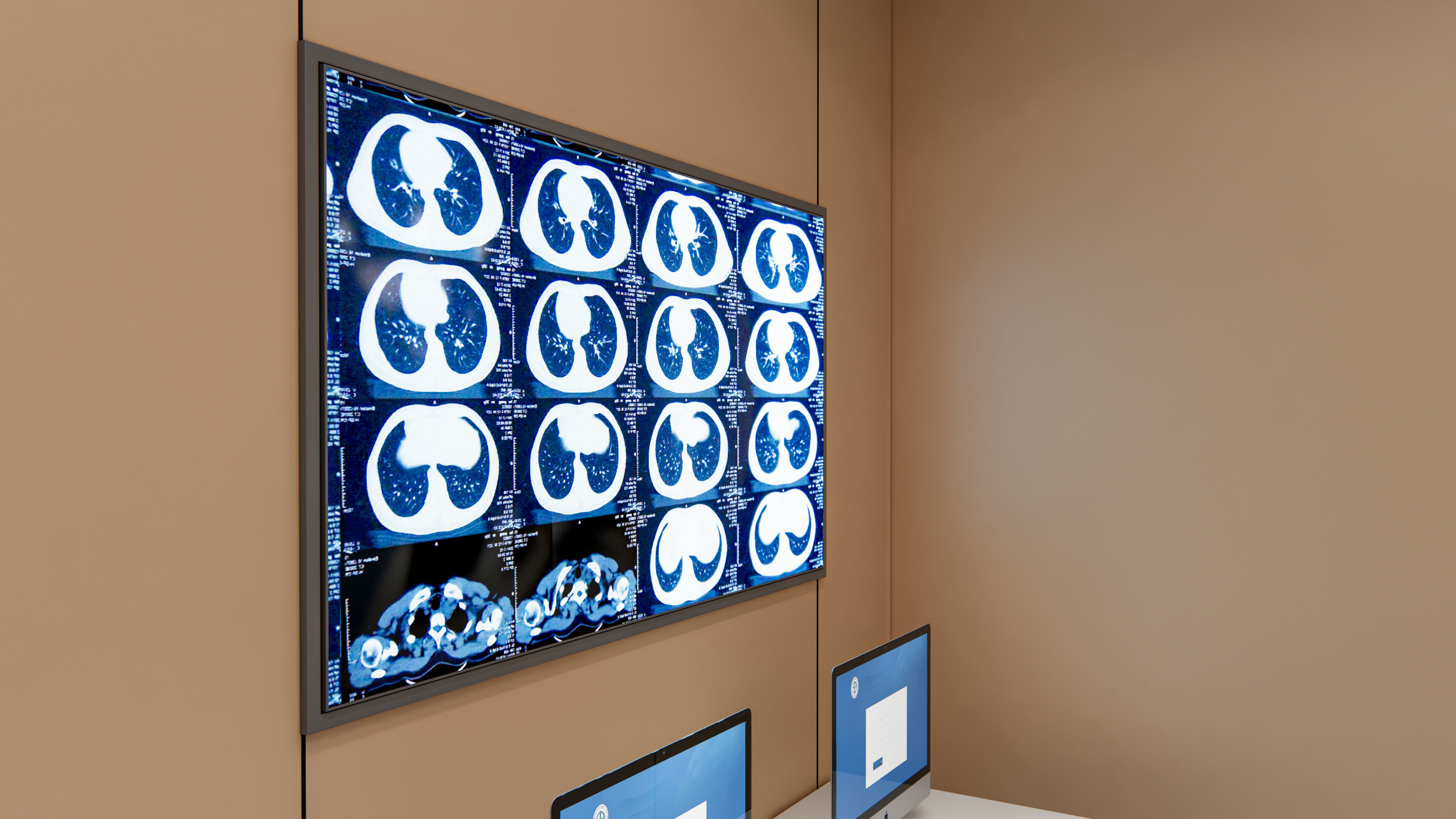 Hospital endoscopy room Interior 3D model | CGTrader