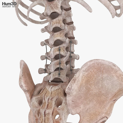 Spinal Fixation System 3d Model Cgtrader