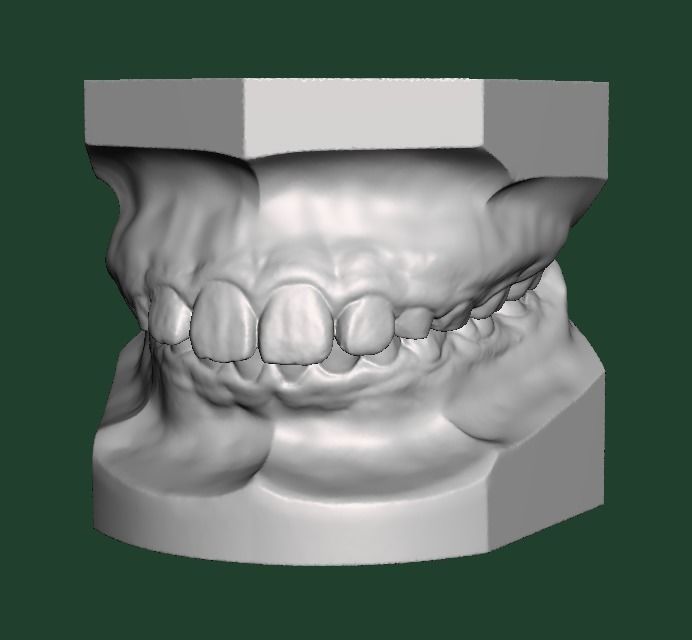 D013 Pediatric dental model from IOS 3D model 3D printable | CGTrader