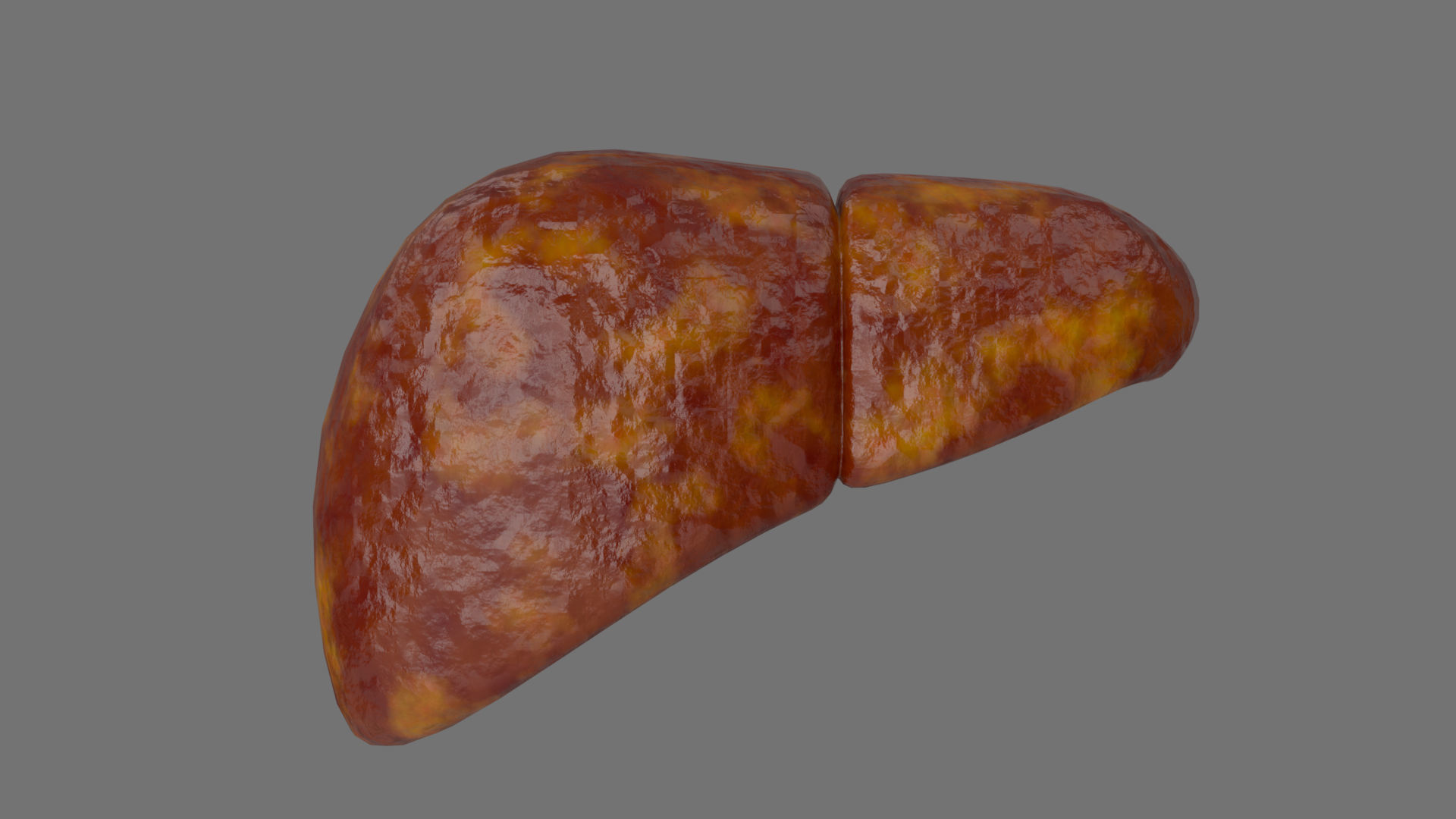 Hepatic Steatosis - Liver Fat 3D model | CGTrader